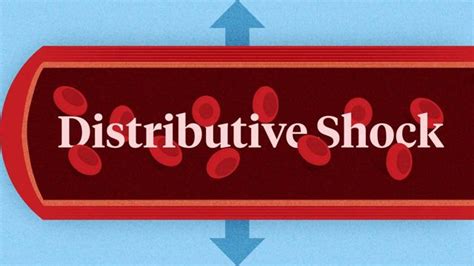 Image result for Distributive Shock