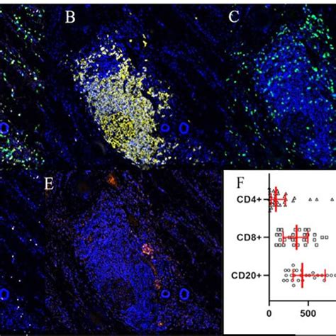 Image result for Tissue Microarray Multiplex IHC NCR