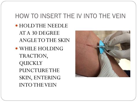 Image result for Insert IV Line