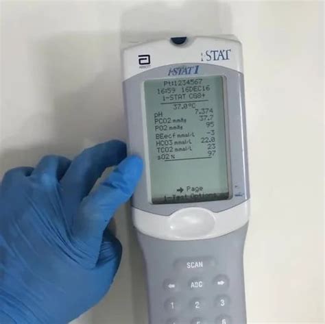 Image result for Istat ABG Machine