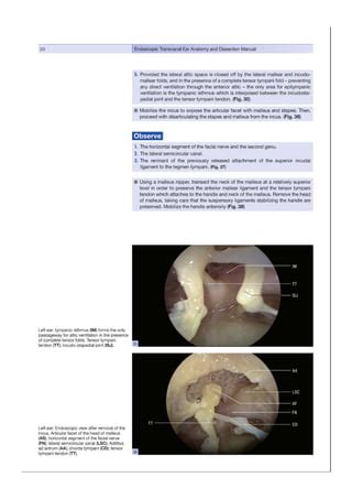Image result for Ear Dissection