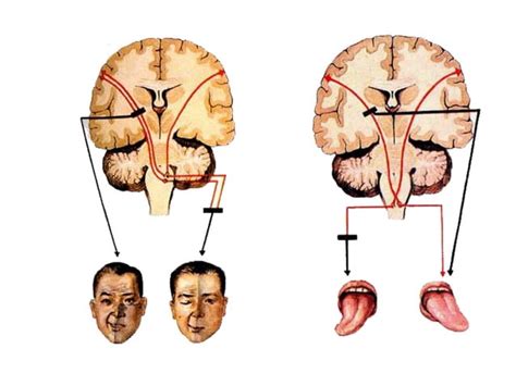 Image result for Extrapyramidal System Pathway
