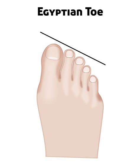 Image result for Different Types of Toes