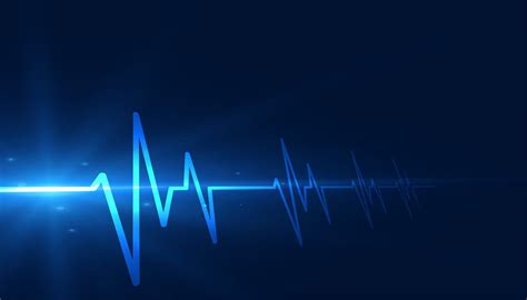 Image result for Telemetry Monitor