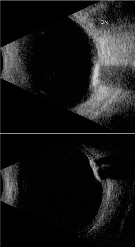 Image result for Scanned Linear Array