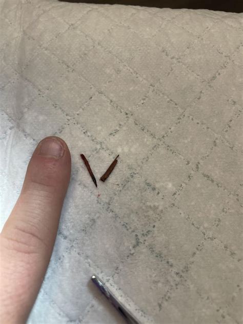 Image result for Splinter Foot