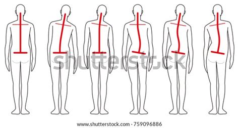 Image result for AVG Back Shape