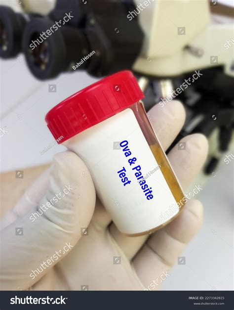 Image result for Stool Sample Test