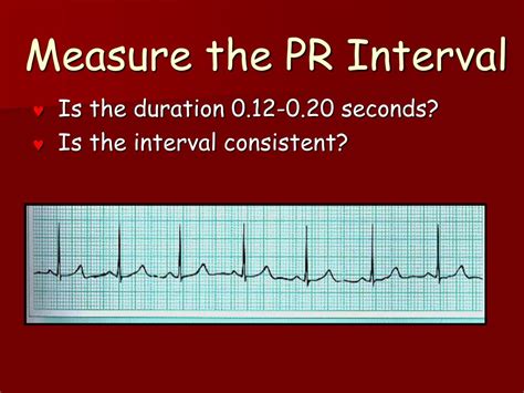 Image result for PR Interval ECG