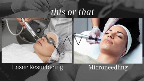 Image result for Micro Resurfacing