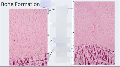 Image result for 2 Types of Bone Formation
