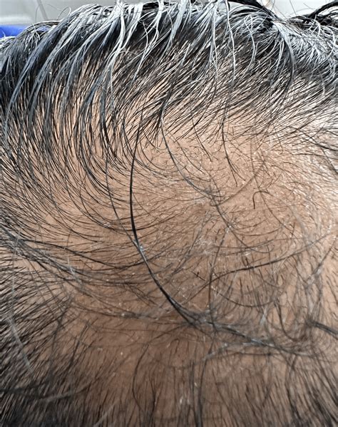 Image result for Seb Derm