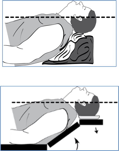 Image result for Intubation Position