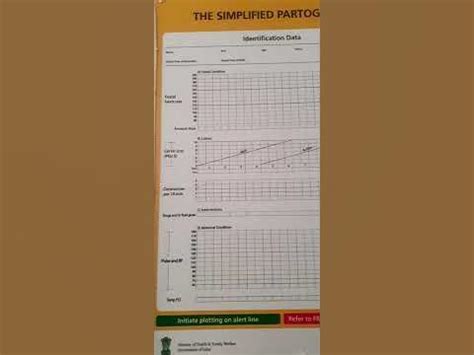 Image result for Types of Partograph