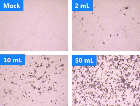 Image result for AAV Vector Purification Kit