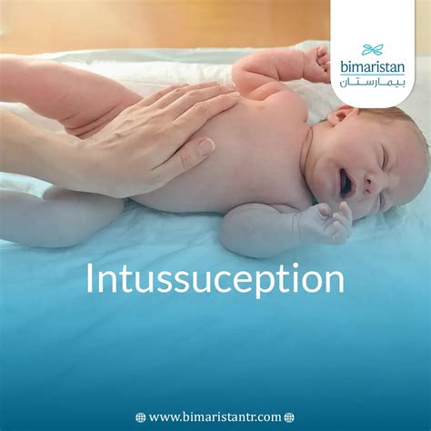 Image result for Intussusception in Arabic