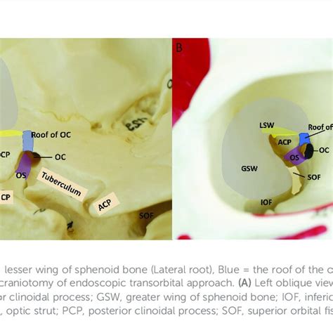 Image result for ACP Linked with Static Structural
