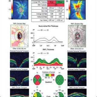 Image result for Oct Check