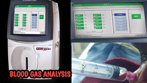 Image result for ABG Testing Machine Southeastern Trust