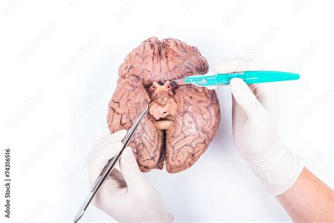 Image result for Brain Dissection
