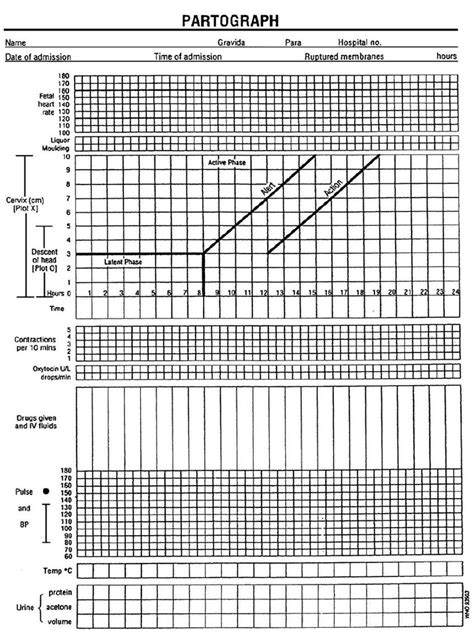 Image result for Normal Partograph