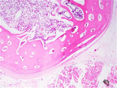 Image result for Normal Bone Formation