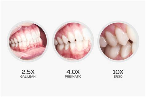 Image result for Magnification Optics