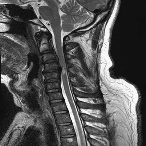 Image result for Tromner Sign Demonstration