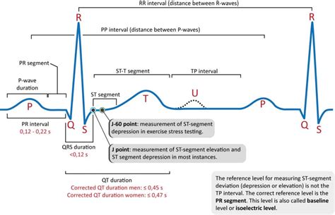 Image result for PR Interval ECG Boxes