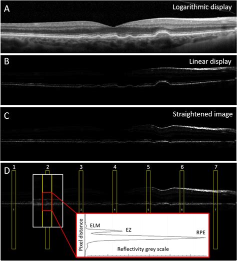 Image result for Oct Line Scan