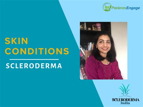 Image result for Scleroderma Skin