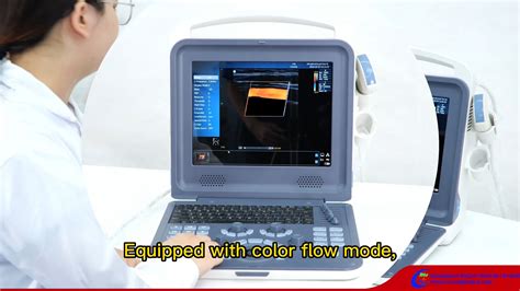 Image result for Color Ultrasound Machine