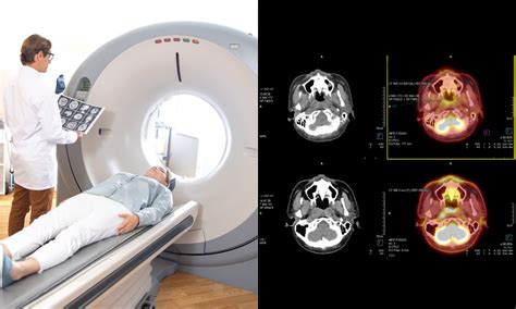 Image result for How CT Scanning Works