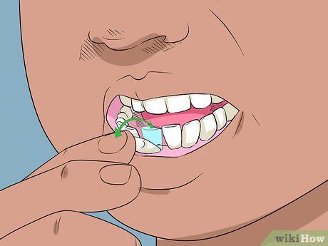 Image result for Tooth Out Pull Fail