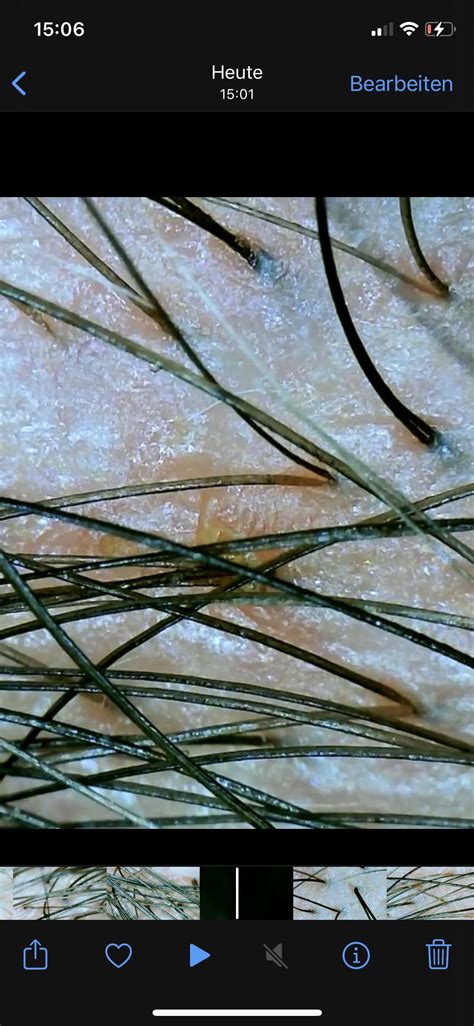 Image result for Seb Derm