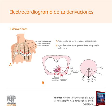 Image result for ECG 12 Derivaciones Normal
