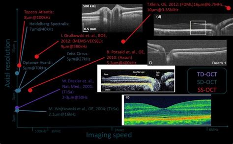 Image result for Oct Axial Resolution