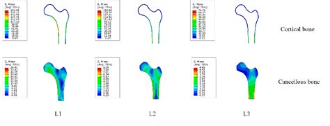 Image result for Trabecular Bone Structure