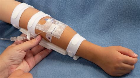 Image result for IV Line Infiltration