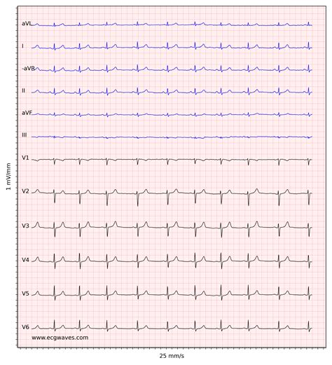 Image result for Normal ECG Range Chart