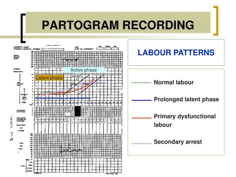 Image result for Partogram Paper