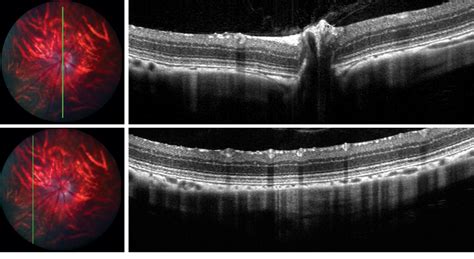 Image result for Oct Check