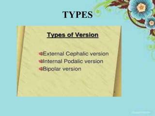 Image result for External Cephalic Version Step by Step