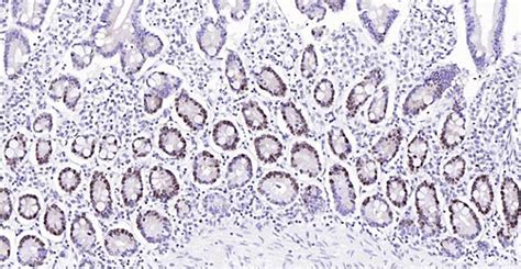 Image result for Multiplex IHC Kit