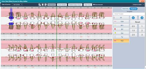 Image result for How to Read a Perio Chart