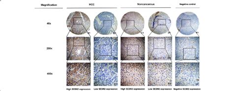 Image result for Tissue Microarray Multiplex IHC NCR