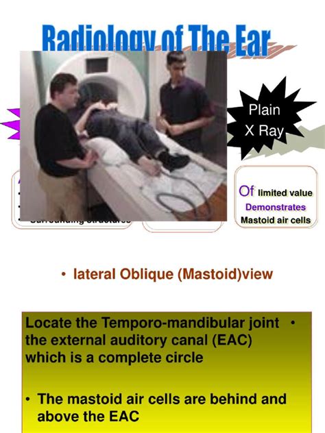 Image result for Outer Ear Angiogram