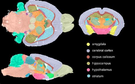 Image result for Mouse Brain Dissection