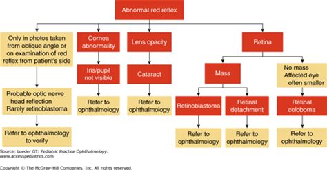 Image result for Red Reflex