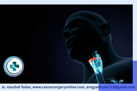 Larynx Cancer - Essential Information and Treatment Options